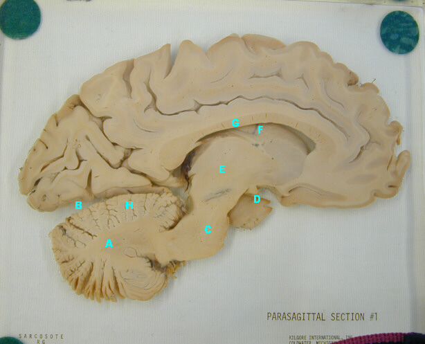 Brain: Parasagittal Section