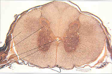 Image #55: Spinal Cord: